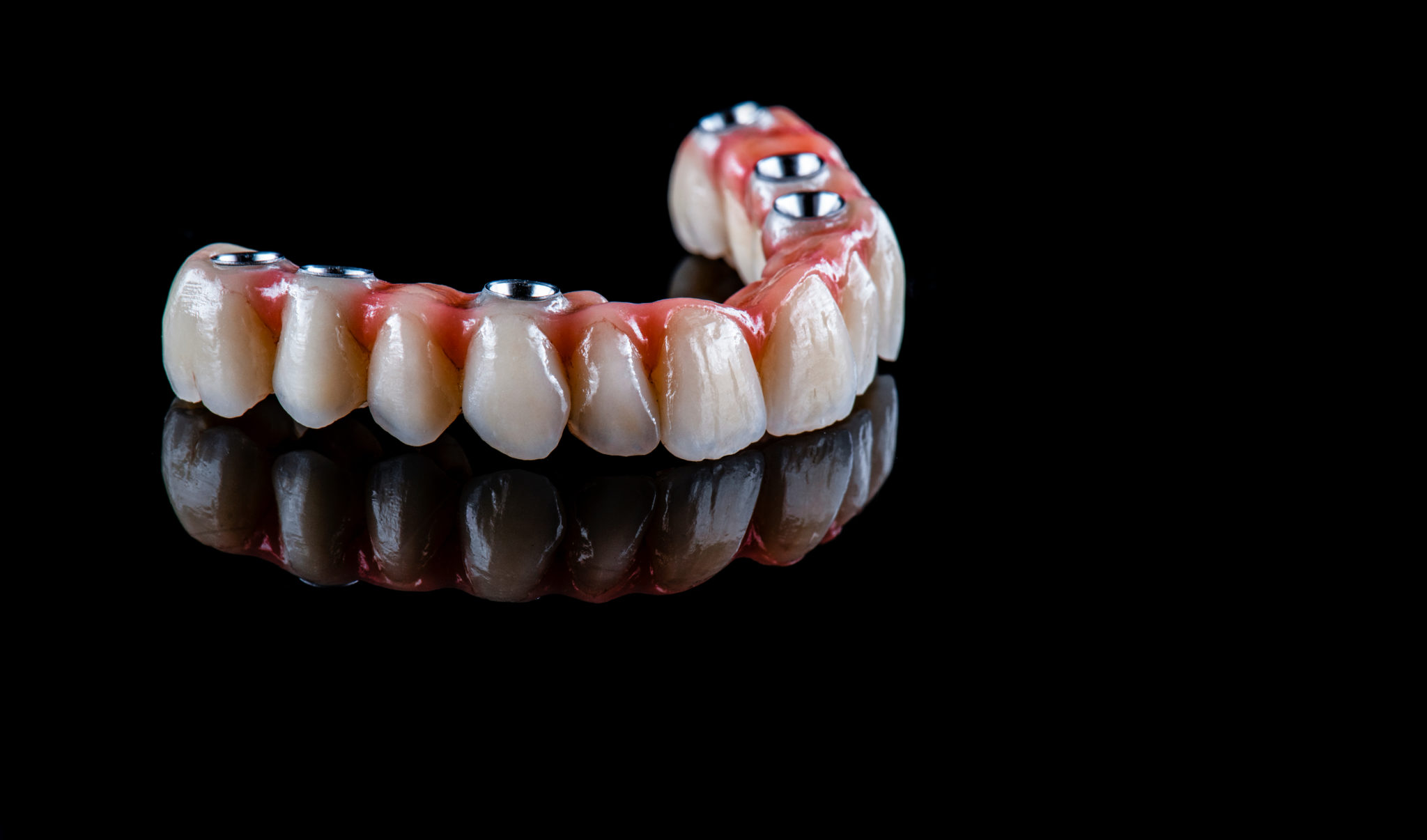 Implant Dentures – Princeton Dental Clinic